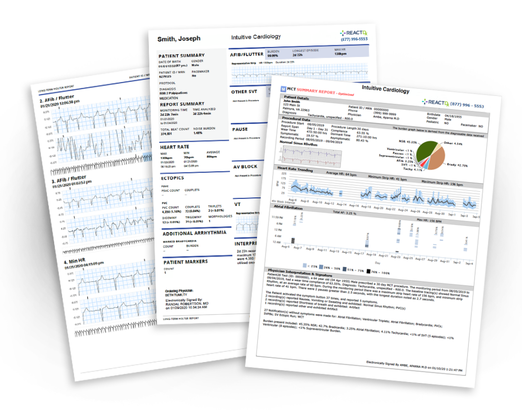 ReactDx | Cardiac Monitoring Solutions for Medical Professionals