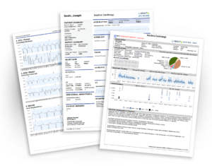 ReactDx | Cardiac Monitoring Solutions for Medical Professionals