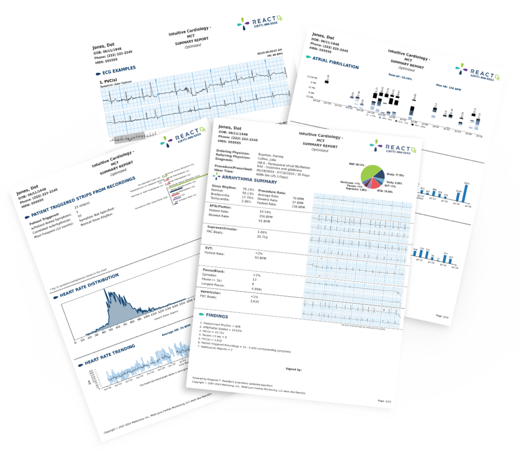 ReactDx | Cardiac Monitoring Solutions for Medical Professionals